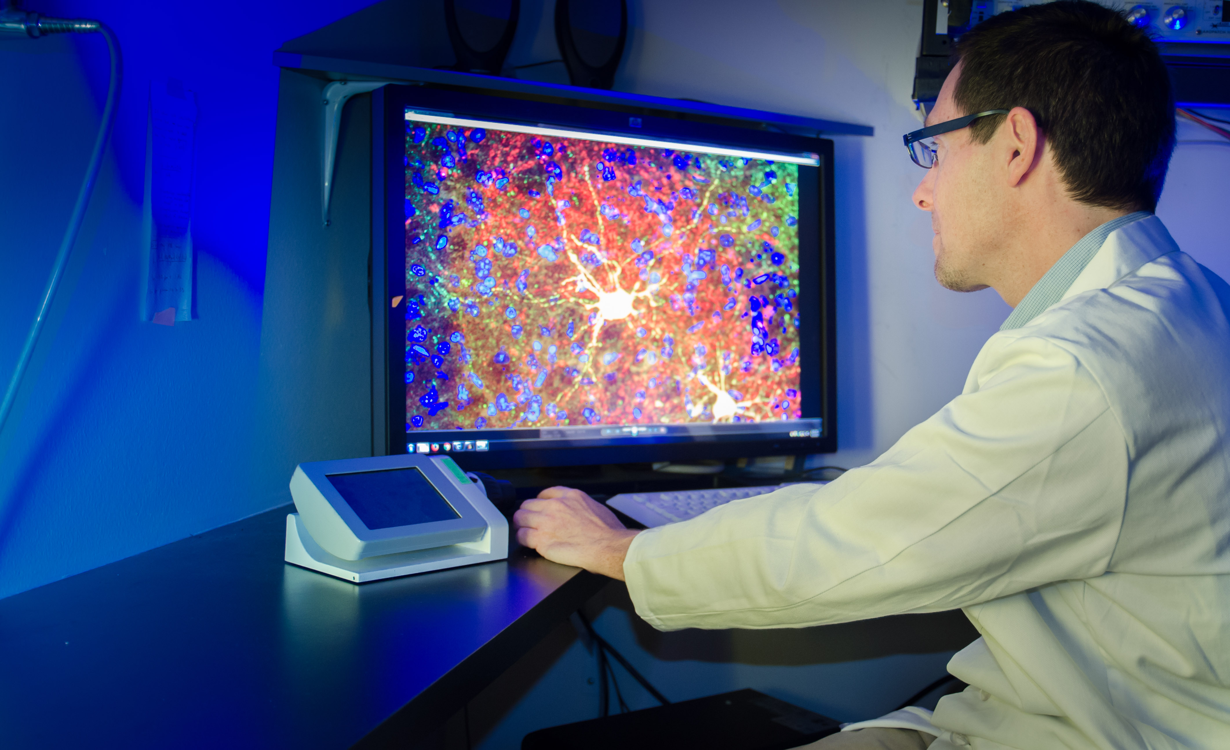 Ophth-128 - UCSF Department of Ophthalmology